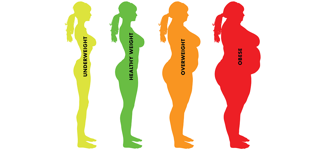 Definition Of Morbid Obesity Based On Bmi Aljism Blog Definition Of Morbid Obesity Based On Bmi Aljism Blog