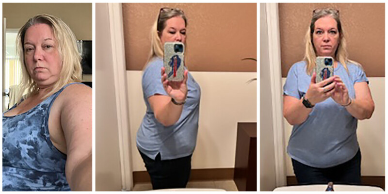 Diane Kochilas Weight Loss Surgery